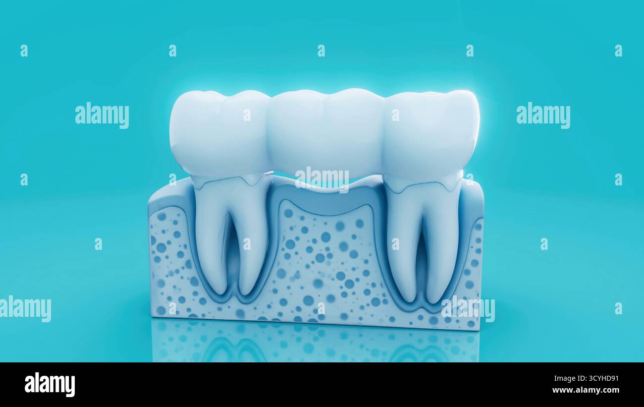 Conceptual 3d animation dental bridge hi-res stock photography and ...