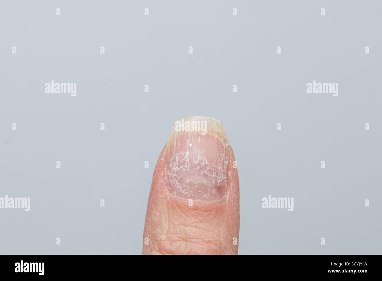 Fingerdetail hi-res stock photography and images - Alamy