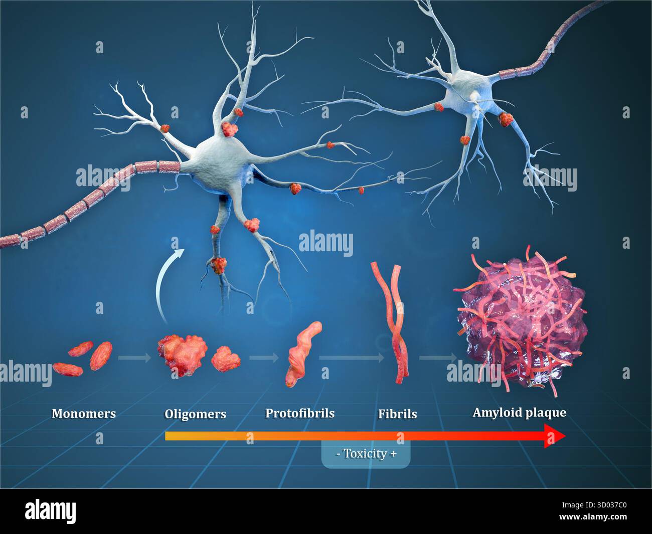 Diagram showing different steps leading to the formation of amyloid ...