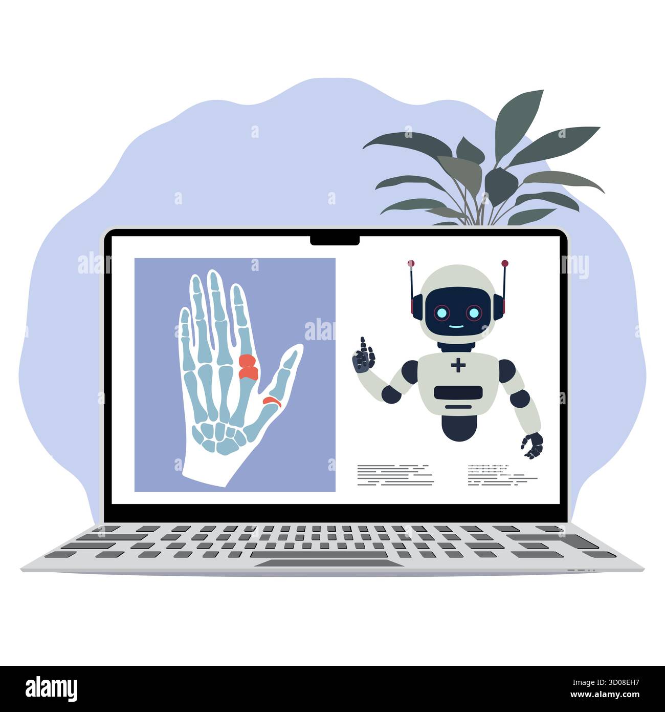 Robot doctor analyzing hand x-ray on laptop screen with plant in ...