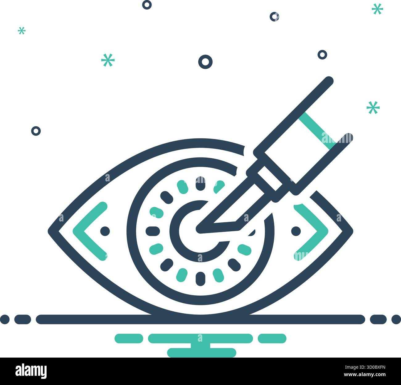 Cataract surgery illustration Stock Vector Images - Alamy