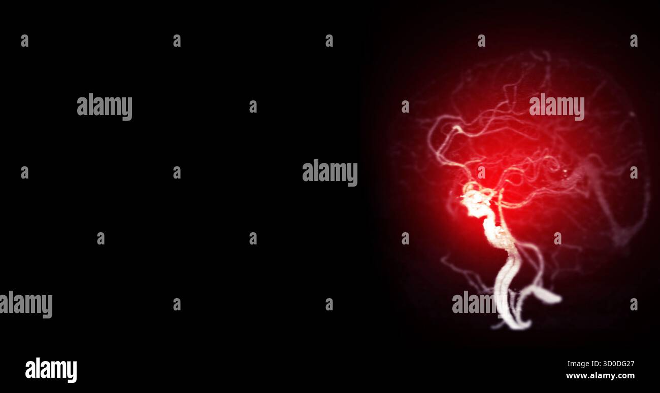 CTA Brain Vascular Imaging , highlights a detailed 3D CTA scan of the ...