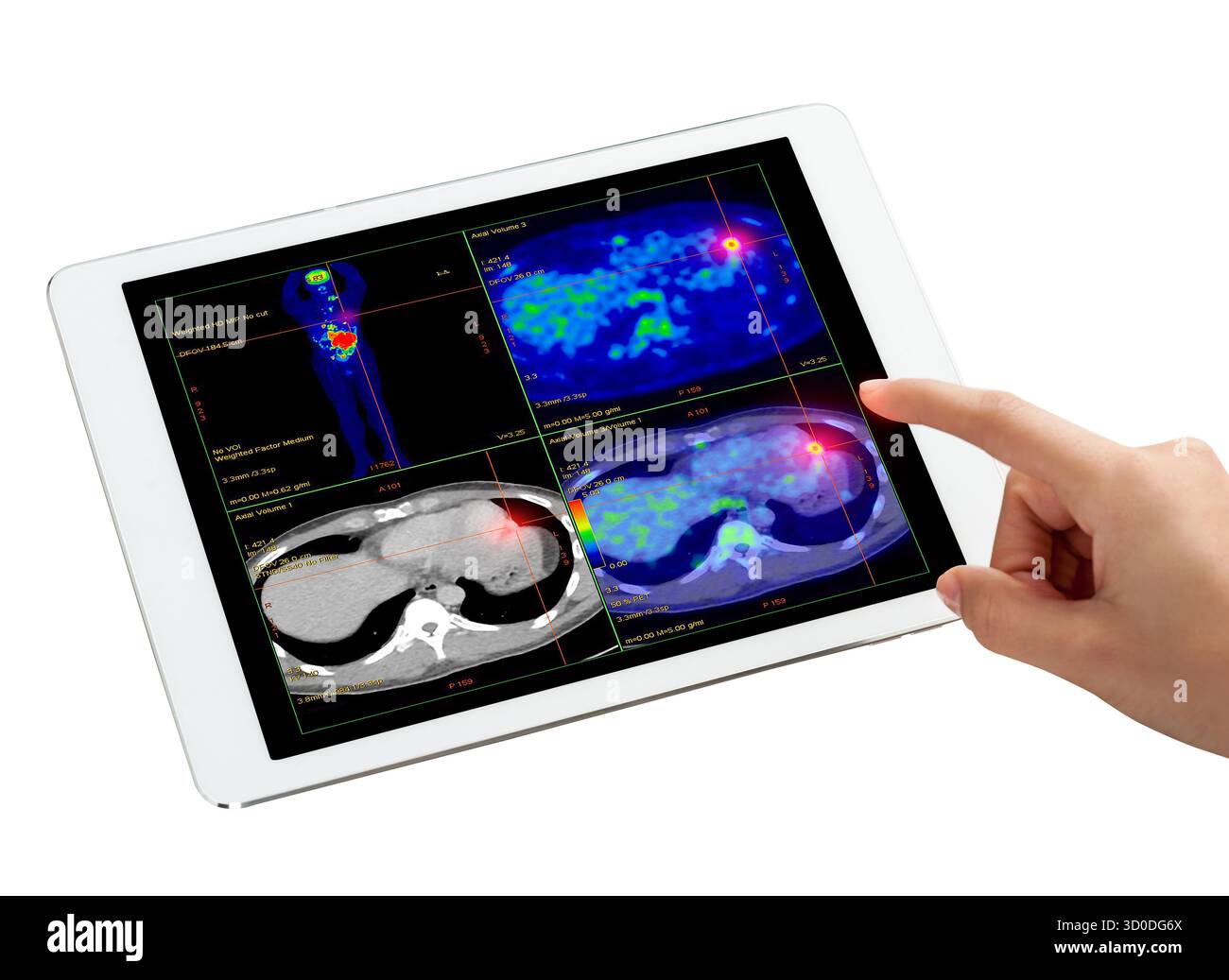 Hand interacting with tablet displaying PET CT scans. Multiview ...