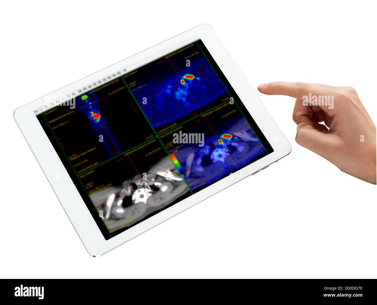 Ct and pet scans hi-res stock photography and images - Alamy