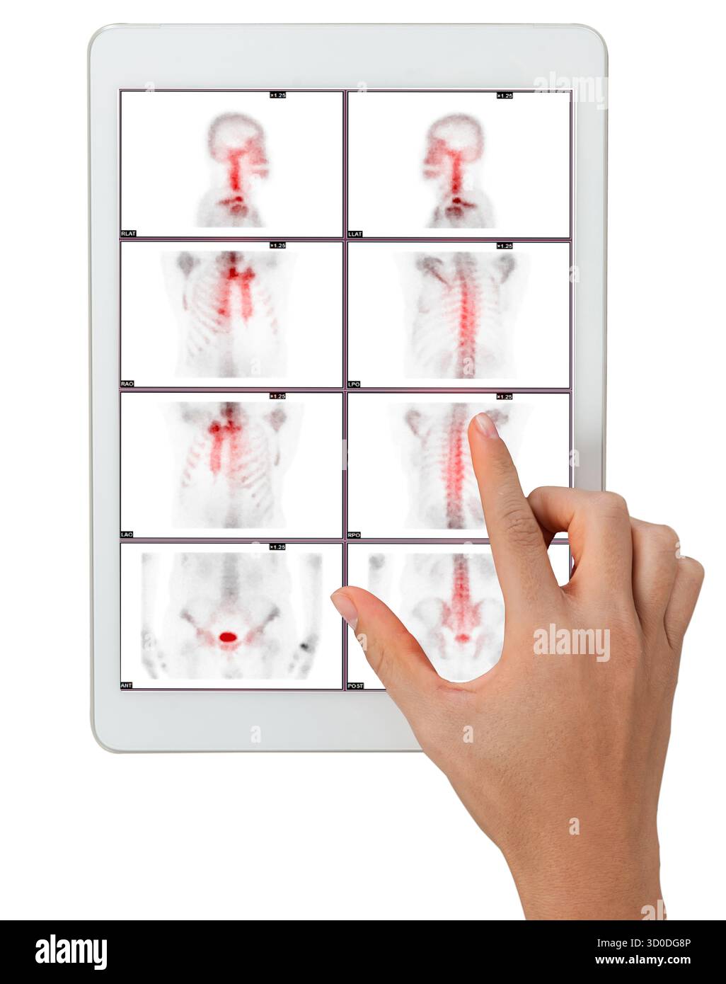 Hand interacting with tablet displaying PET CT scans. Multiview ...