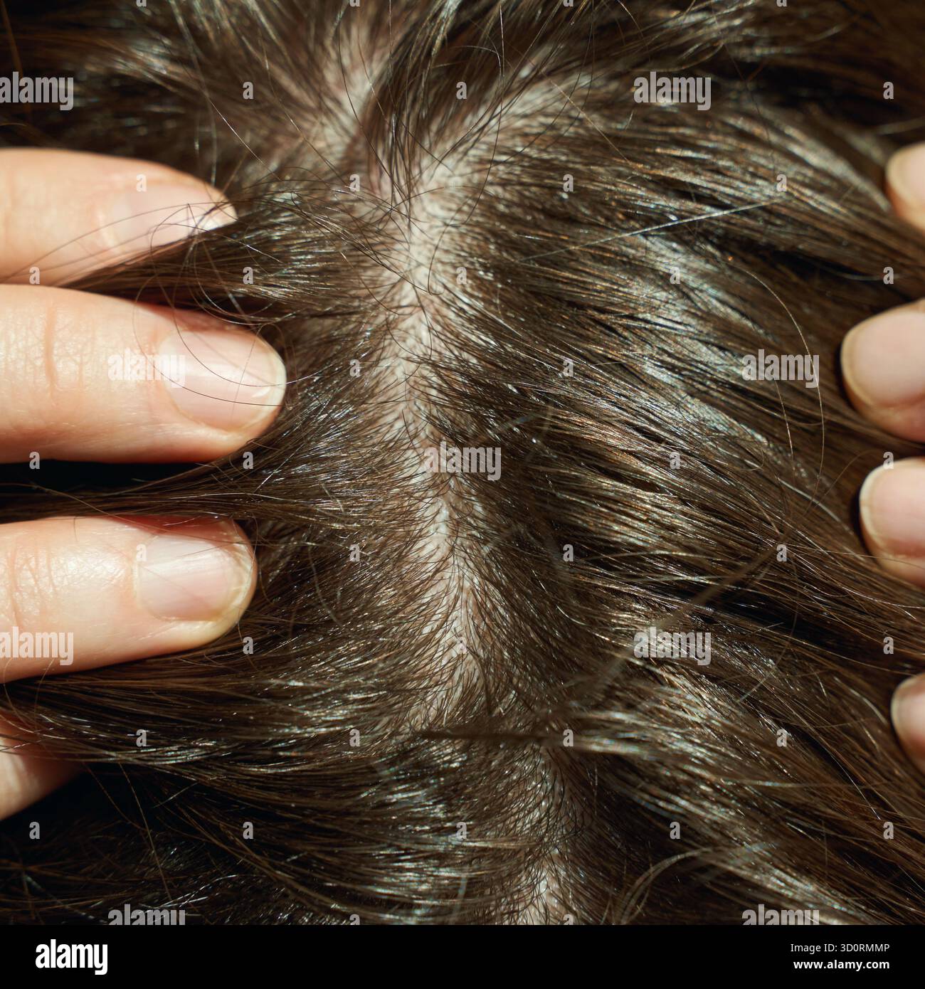 Close-up of caucasian adult scalp with brown hair and hands parting to ...