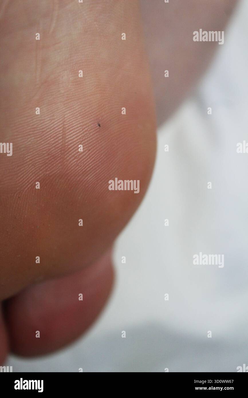 Black dot on sole hi-res stock photography and images - Alamy