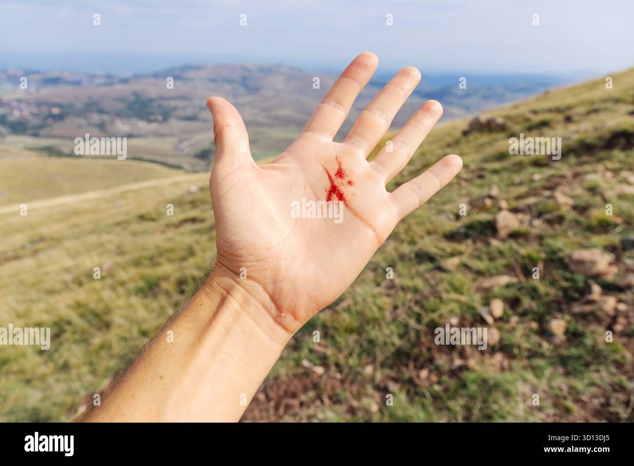 Hand cut blood bleeding hi-res stock photography and images - Alamy