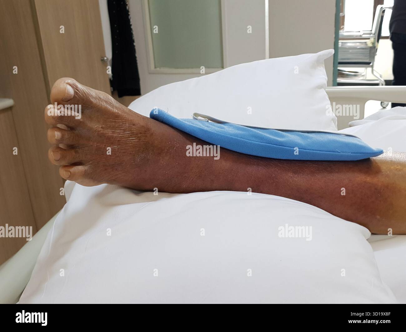 Human bone marrow hi-res stock photography and images - Alamy