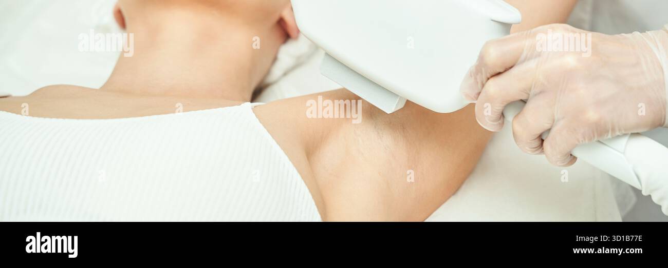 Professional laser hair removal treatment on female underarm with ...