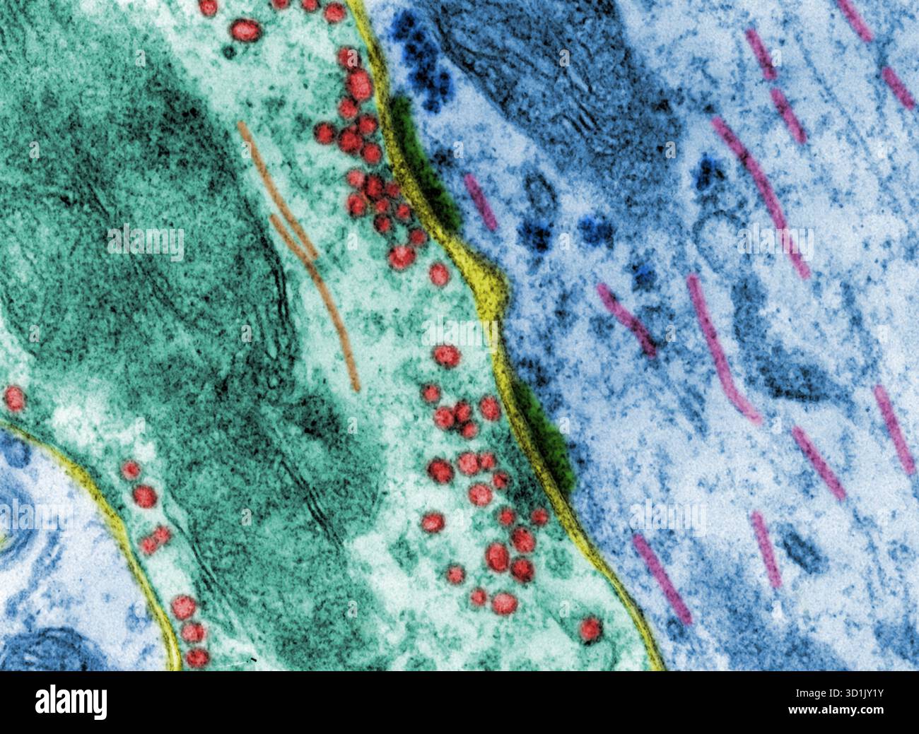 Coloured transmission electron micrograph (TEM) showing a dendrite ...