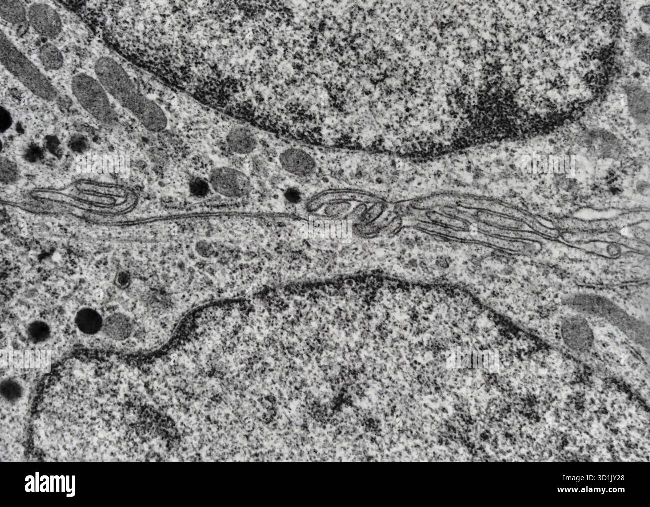 Transmission electron micrograph (TEM) of parathyroid chief cells ...