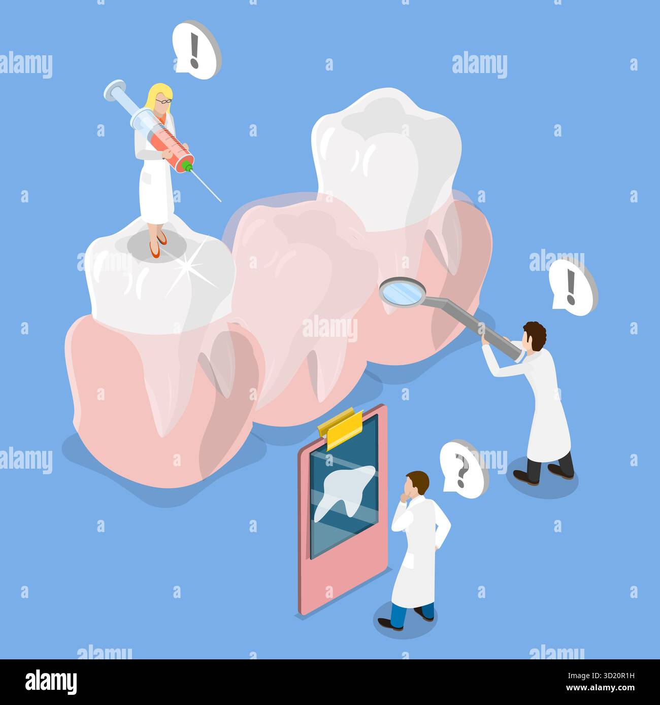 3D Isometric Flat Illustration of Impacted Tooth, Swollen Gum Due to ...