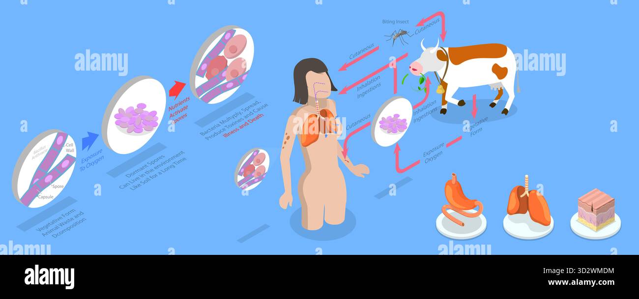 3D Isometric Flat Conceptual Illustration of Anthrax, Labeled Medical ...