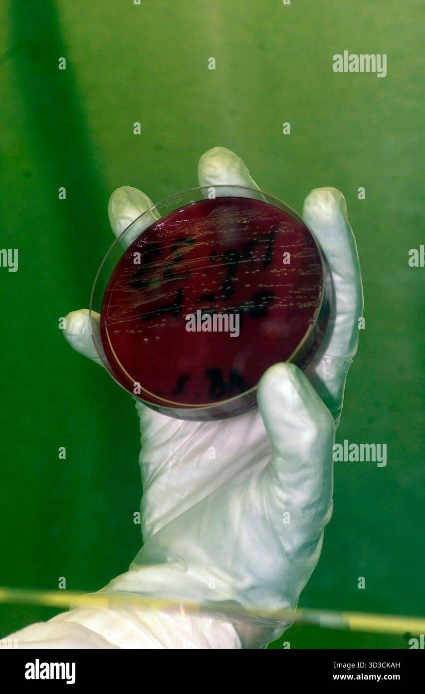 RECORD DATE NOT STATED in a meningococcus laboratory in a research ...