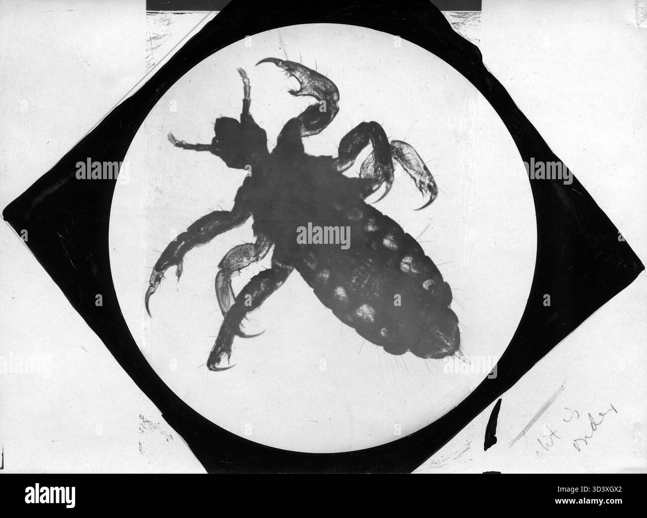 A close-up microscope image from 1919 shows a louse, the carrier of ...