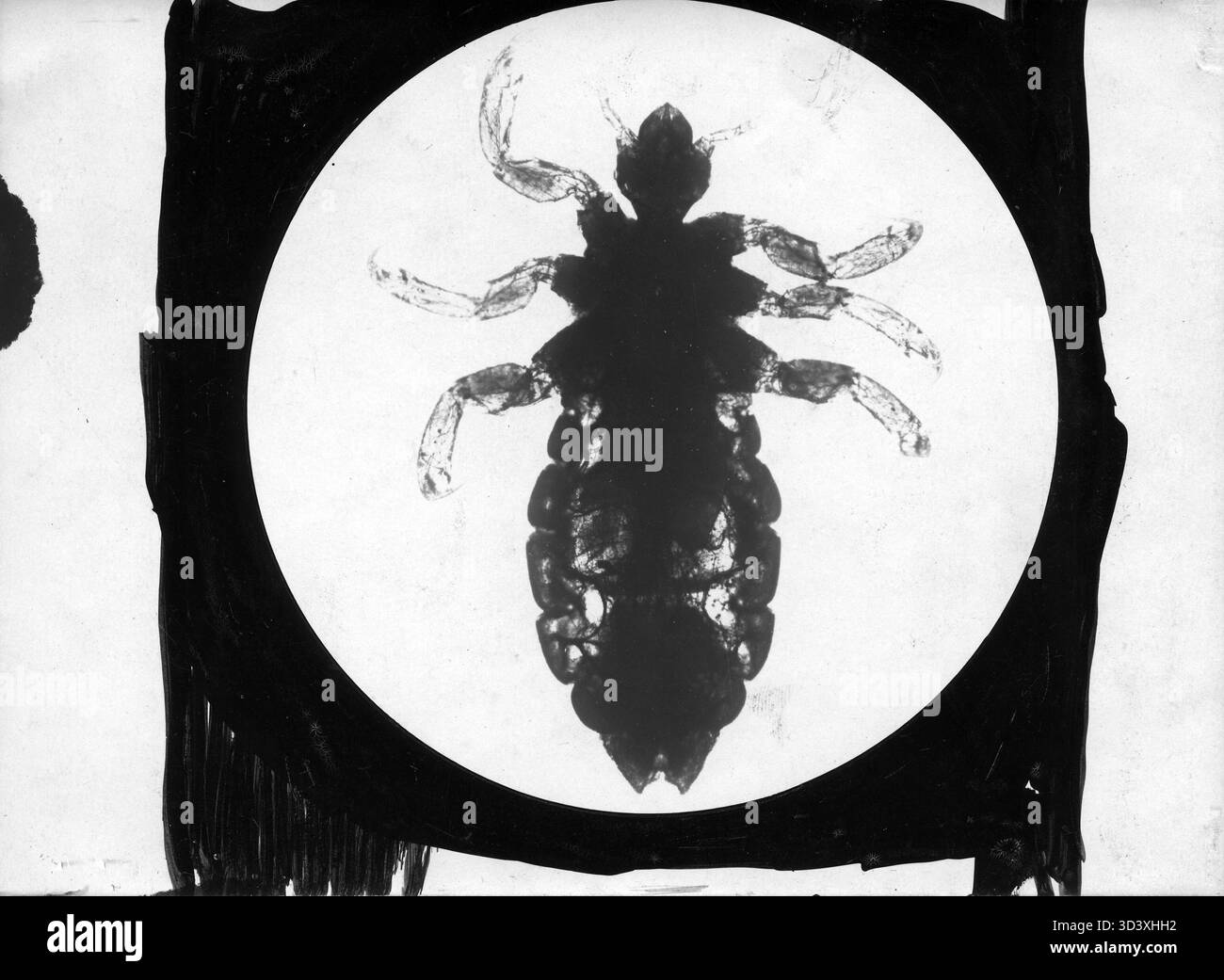 A microscope image from 1919 shows a louse transmitting typhus ...
