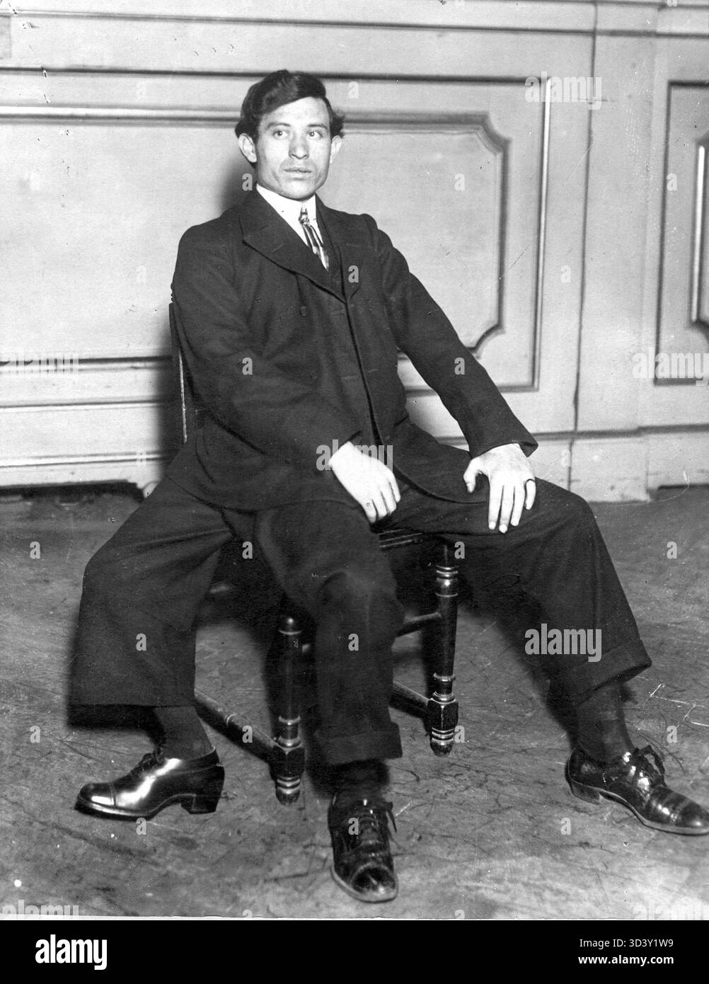 A man with three legs poses for the photographer in Italy in 1913. This ...