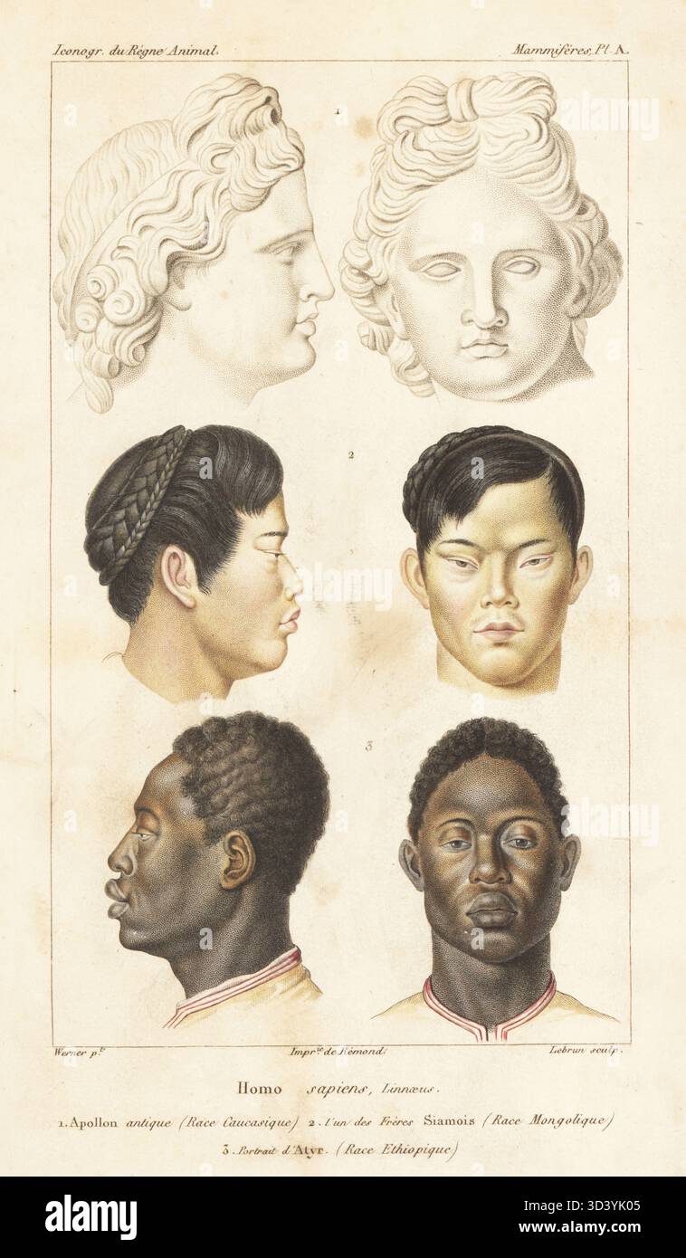 Heads of Homo sapiens: Greek god Apollo 1, one of the Siamese Twins ...