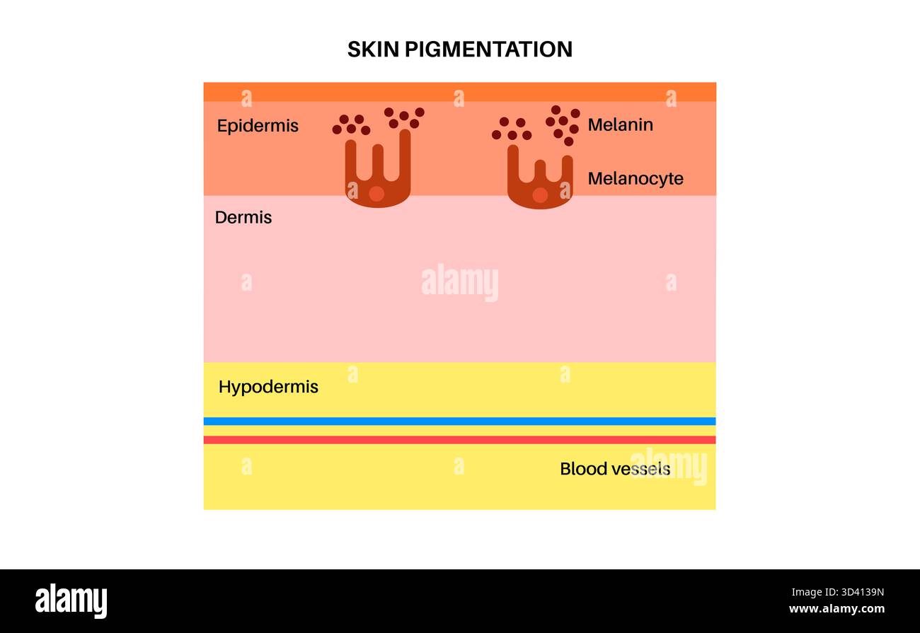 Illustration of skin pigmentation. Melanocytes are specialised cells in ...