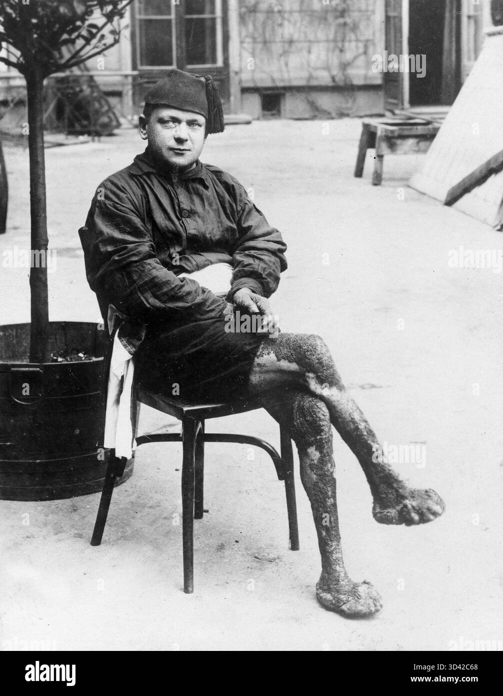 Joseph Gschwendtner, a variety artist known as the ‘Camel-man’ for his ...