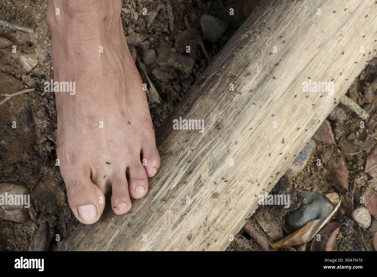 Barefoot human foot experiencing hi-res stock photography and images ...