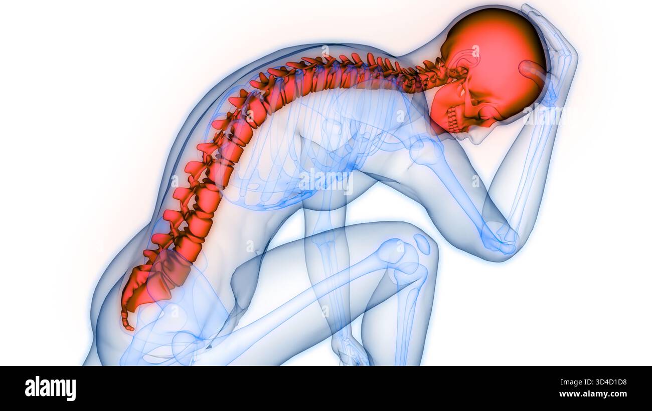 Human Suffering with Severe Headache Anatomy Stock Photo - Alamy