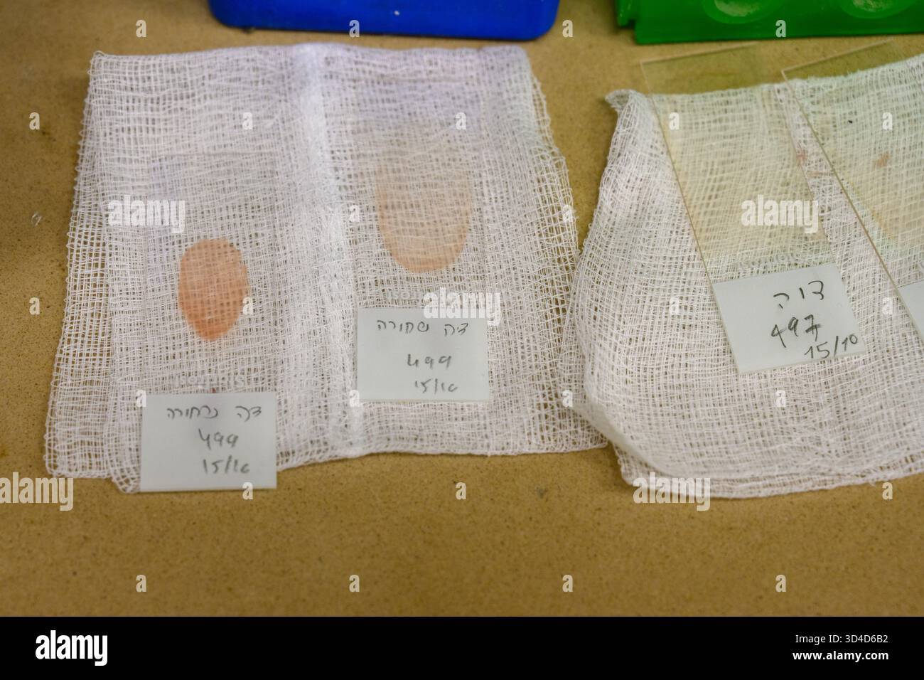 labeled microscope slides with blood samples collected from ...