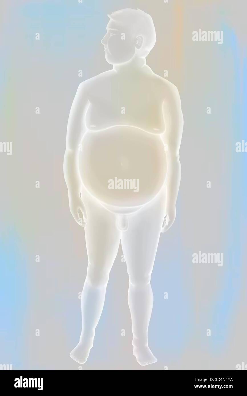 Obese man. There are three types of obesity: android obesity abdomen ...