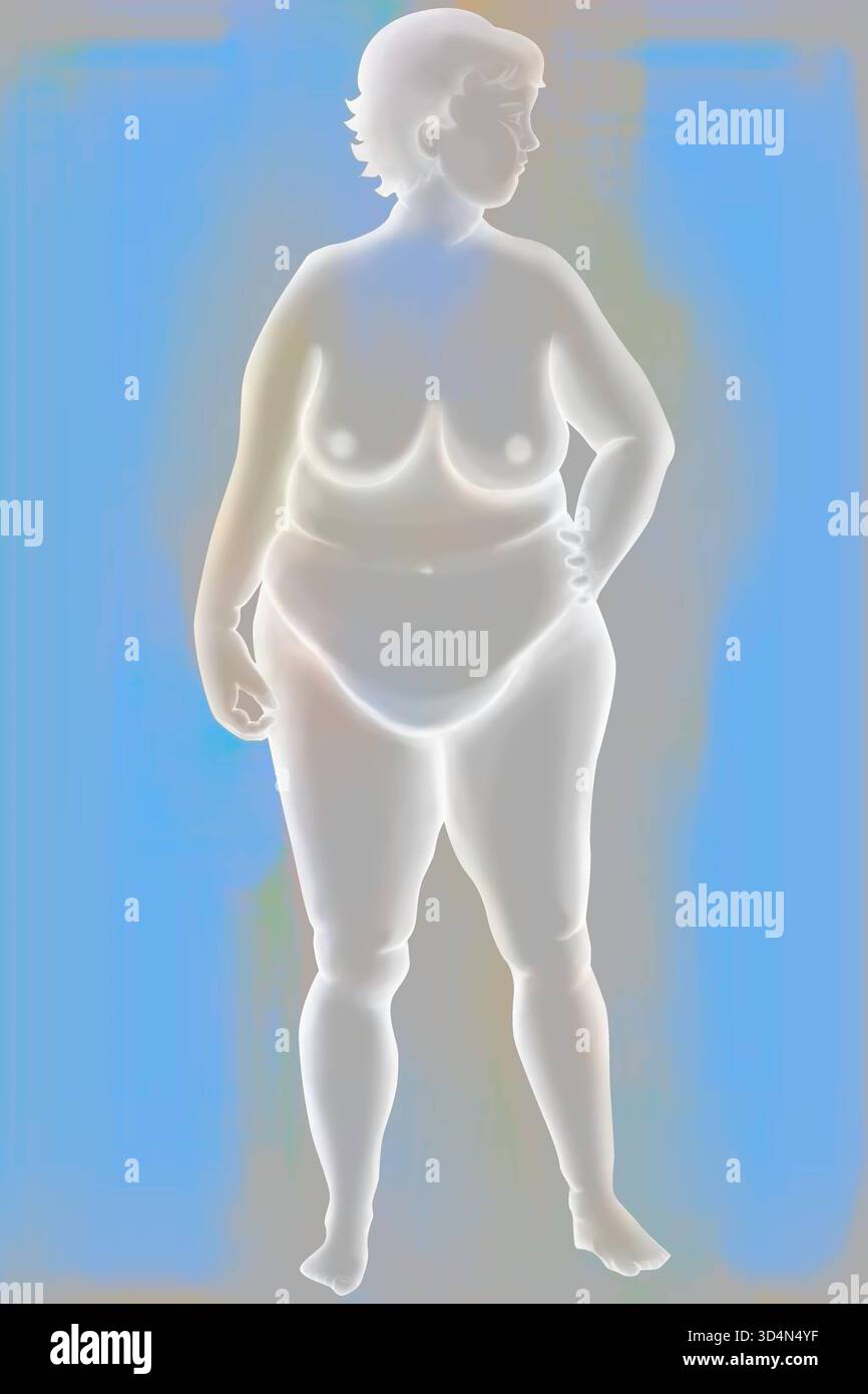 Obese woman. There are three types of obesity: android obesity abdomen ...