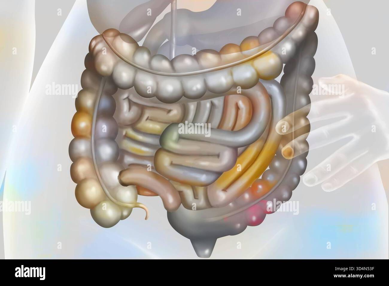 Diverticulosis of colon hi-res stock photography and images - Alamy