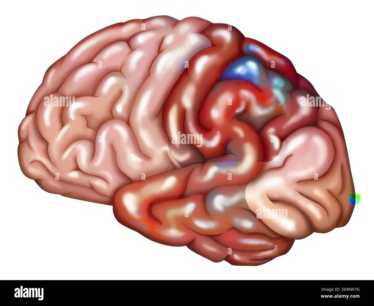 The four lobes of the brain: - frontal lobe, - parietal lobe ...