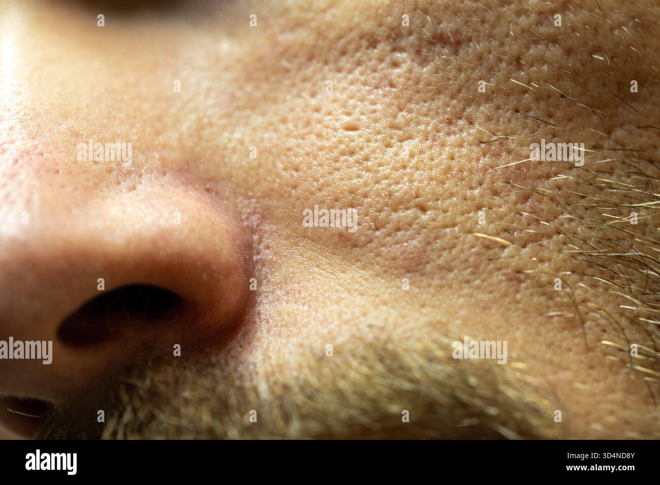 Close-up macro photo man’s nose and upper lip area showing detailed ...