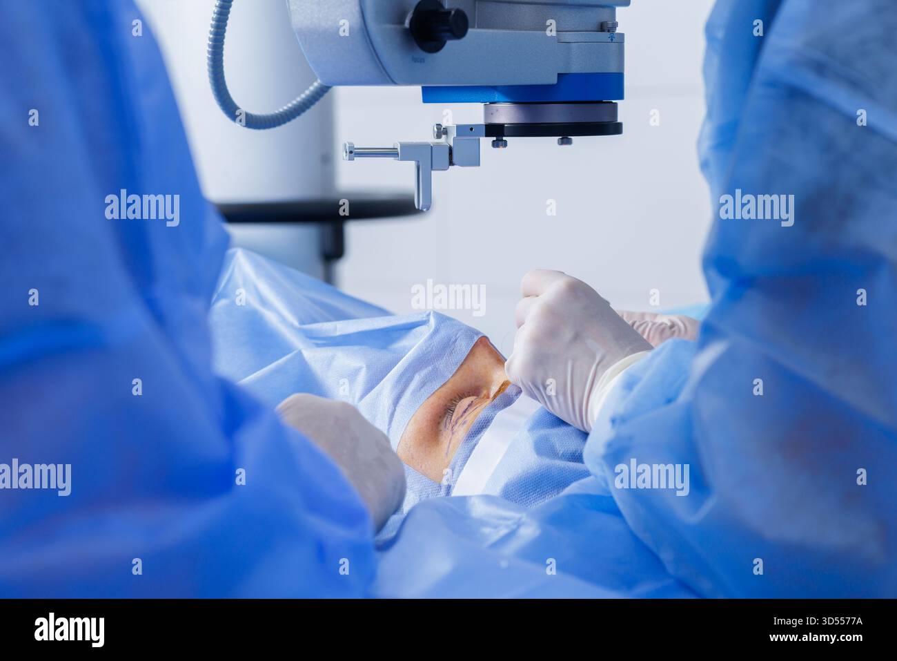 Upper eyelid blepharoplasty in progress under an operating microscope ...