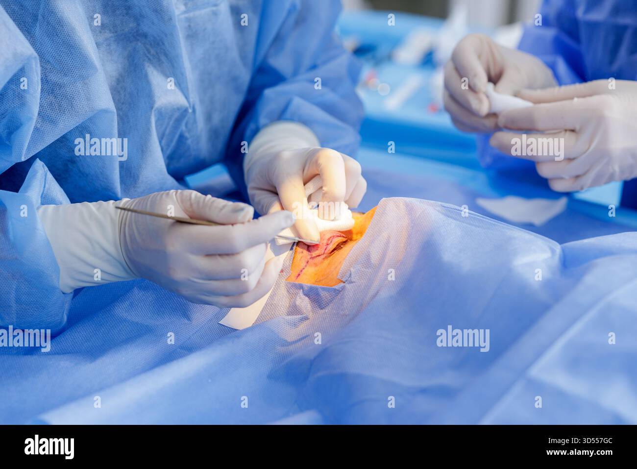 Surgeon using operating microscope during hi-res stock photography and ...
