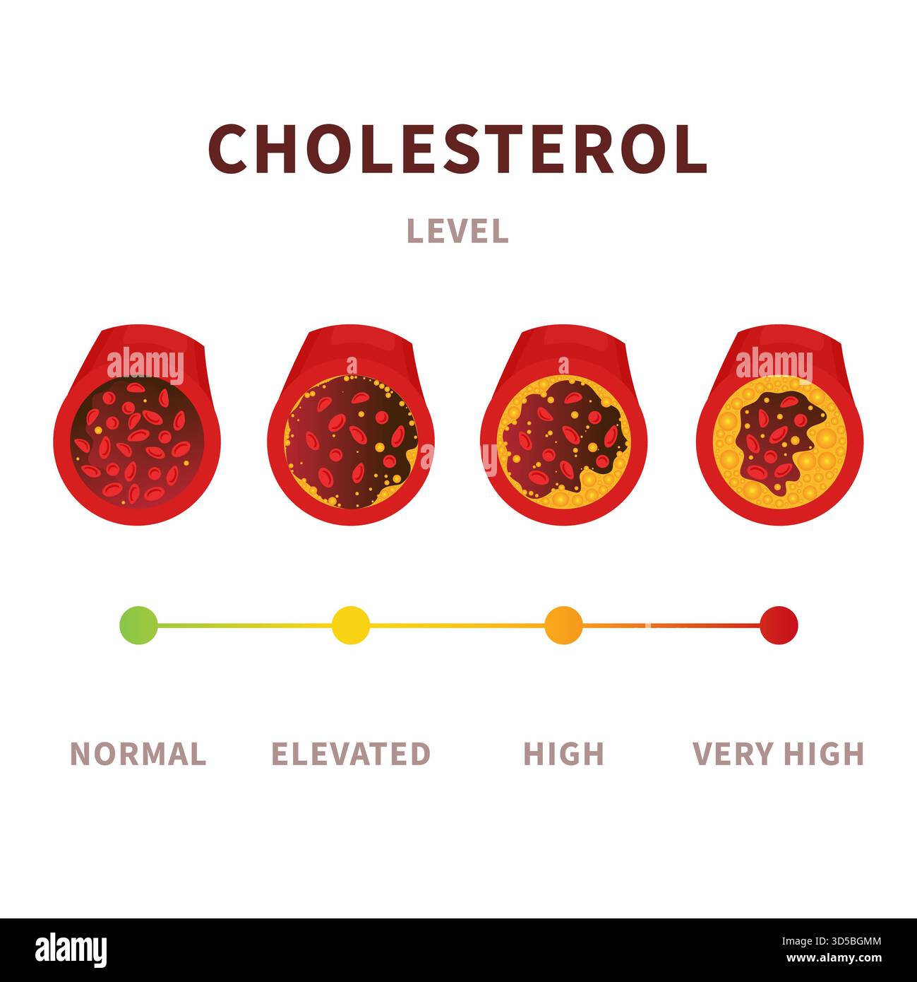 Cholesterol risk, conceptual illustration. Meter gauge measures ...