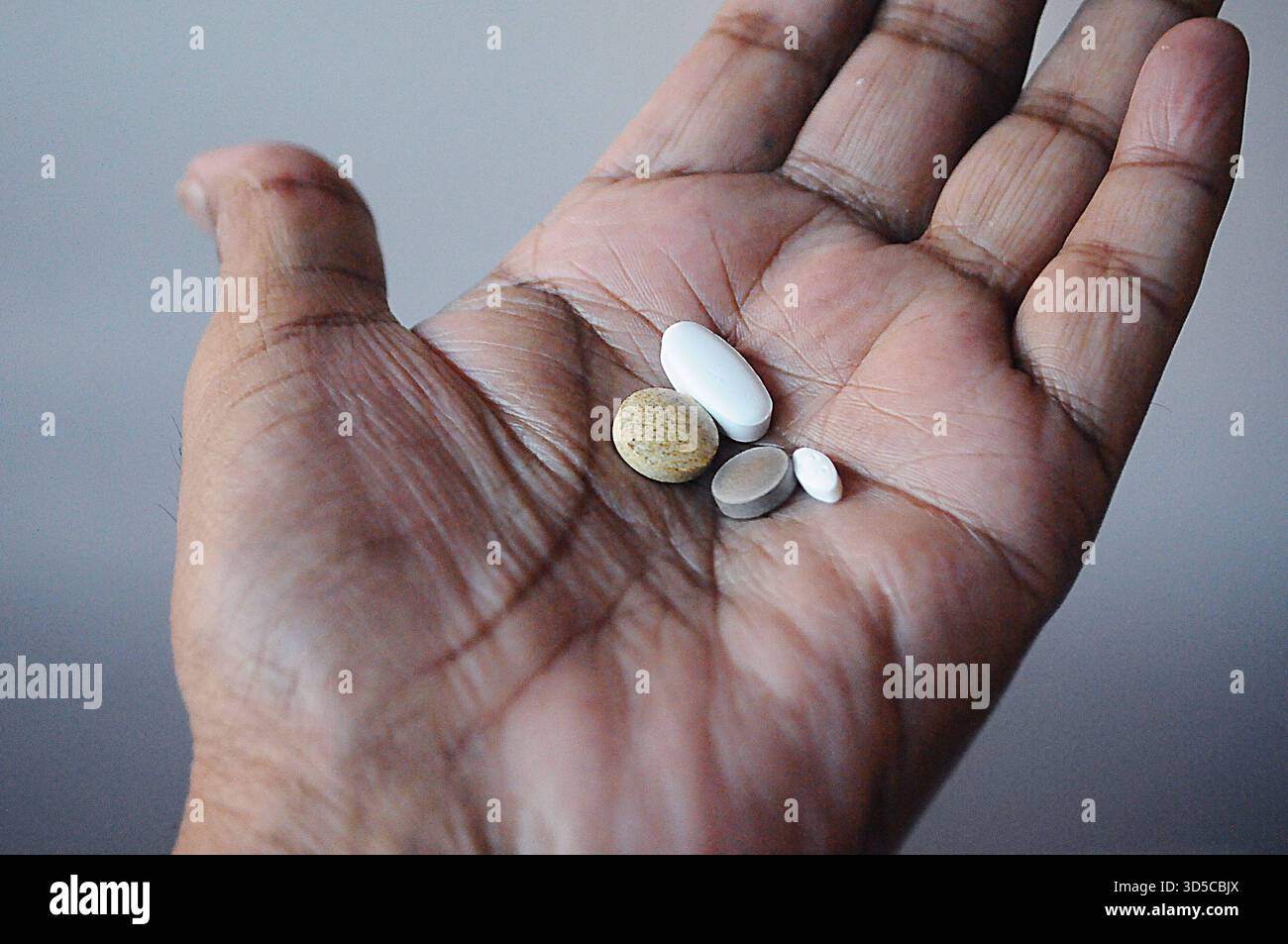 Copenhagen/Denmark/ 14 .november 2025/ Various medicine tablets in palm ...