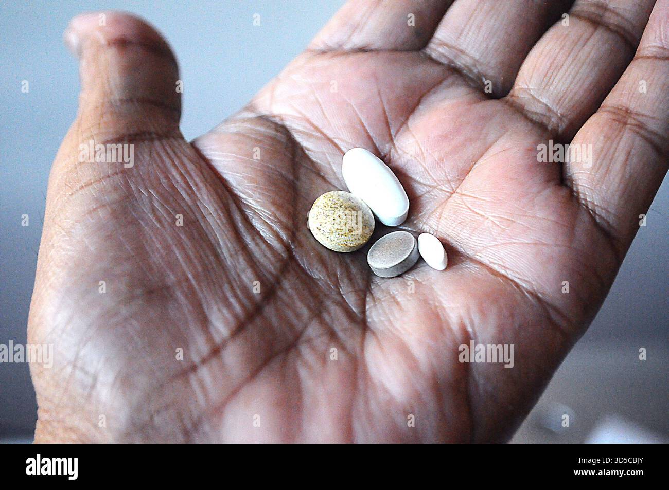 Copenhagen/Denmark/ 14 .november 2025/ Various medicine tablets in palm ...