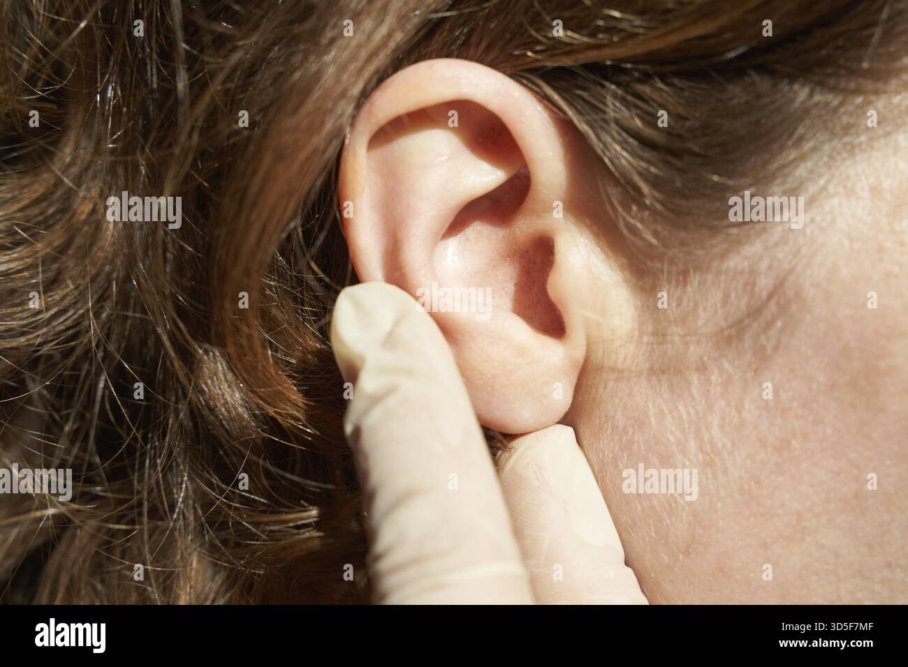 Female caucasian adult ear examined by gloved hand in close-up image ...