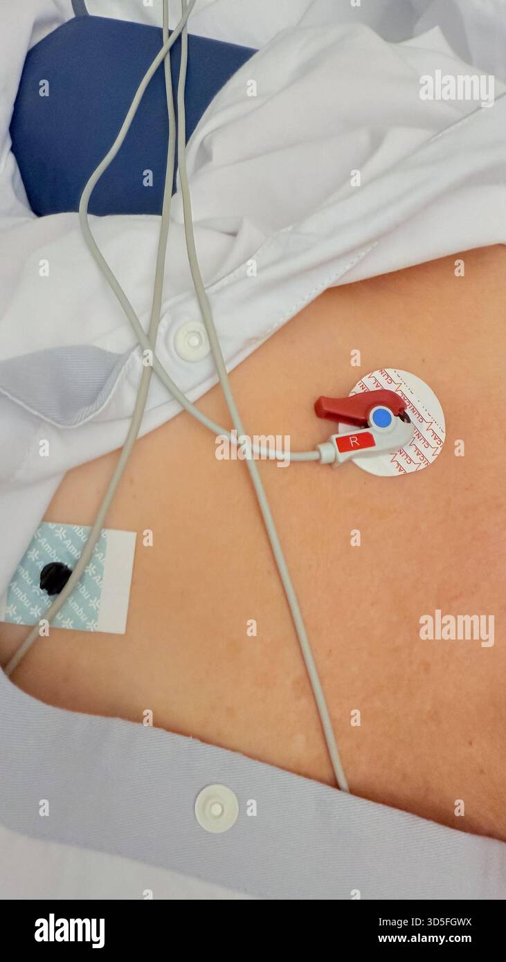 Ecg electrodes on chest hi-res stock photography and images - Alamy
