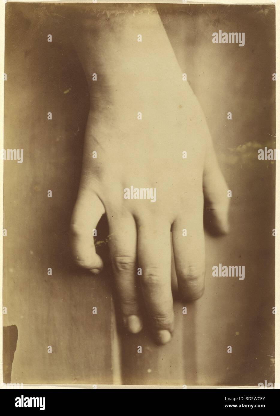 This 1865 European study depicts a human hand, showing anatomy ...