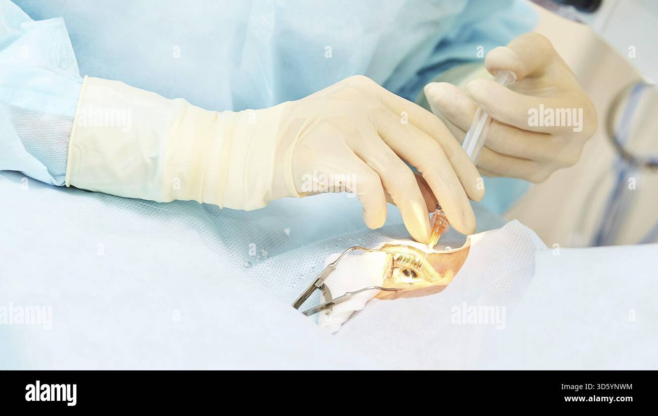 Ophthalmology laser microscope operation. Doctor in clinic. Patient eye ...