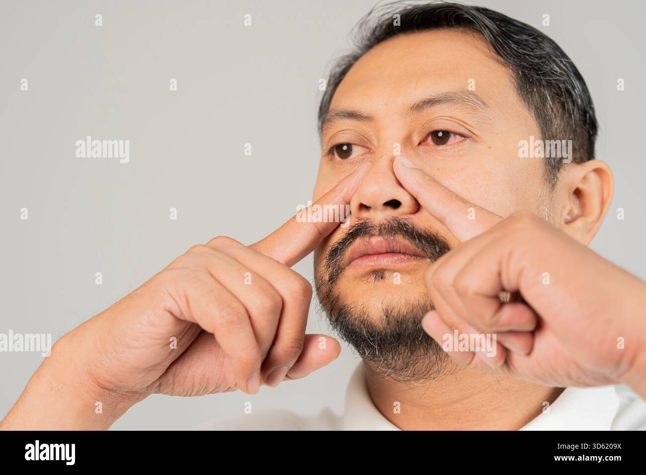 Man suffering chronic Rhinosinusitis, Rhinitis or acute Sinusitis, pain ...