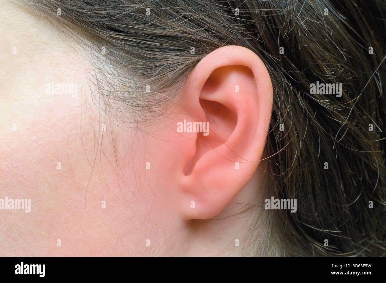 Inflammation symptom hi-res stock photography and images - Alamy