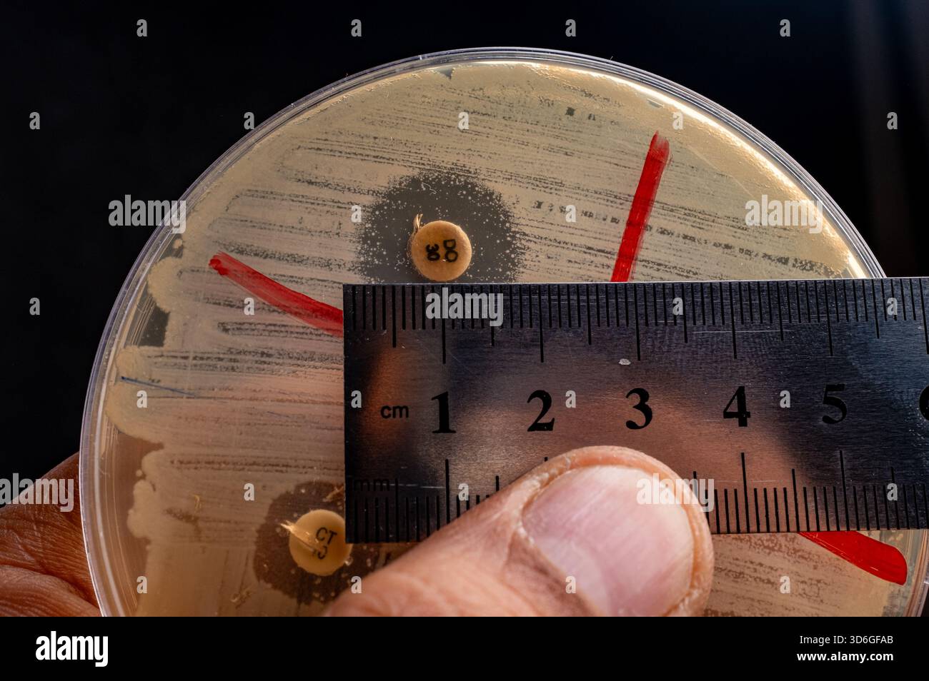 Petri dish with bacterial growth and antibiotic discs, ruler measuring ...
