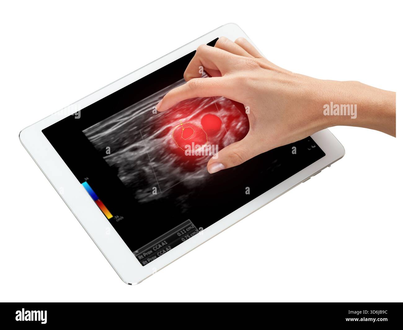 Sonogram of the heart Cut Out Stock Images & Pictures - Alamy