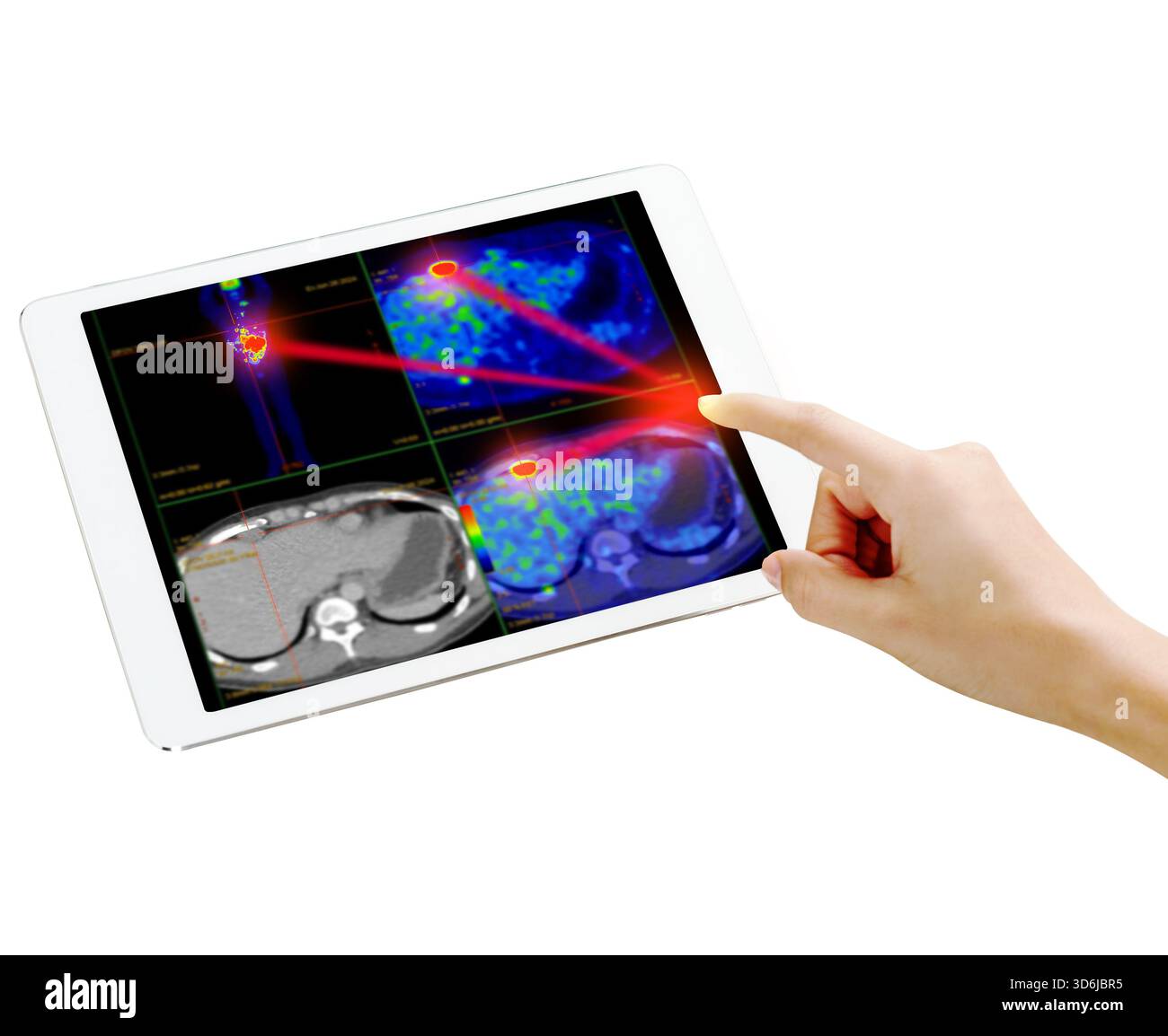 Hand interacting with tablet displaying PET CT scans. Multiview ...