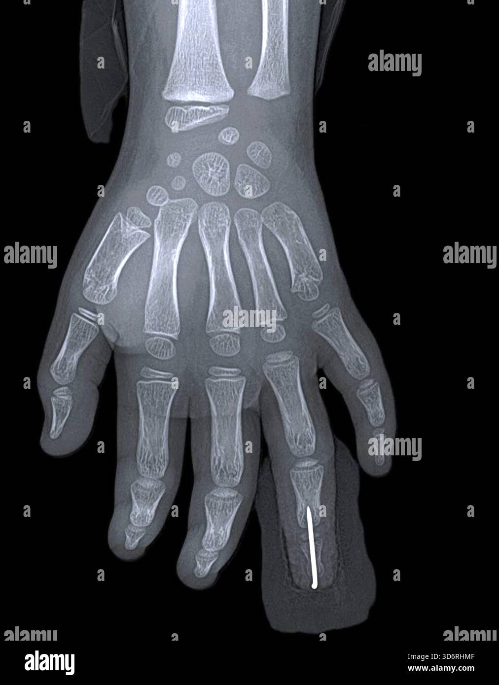 Applying internally hi-res stock photography and images - Alamy