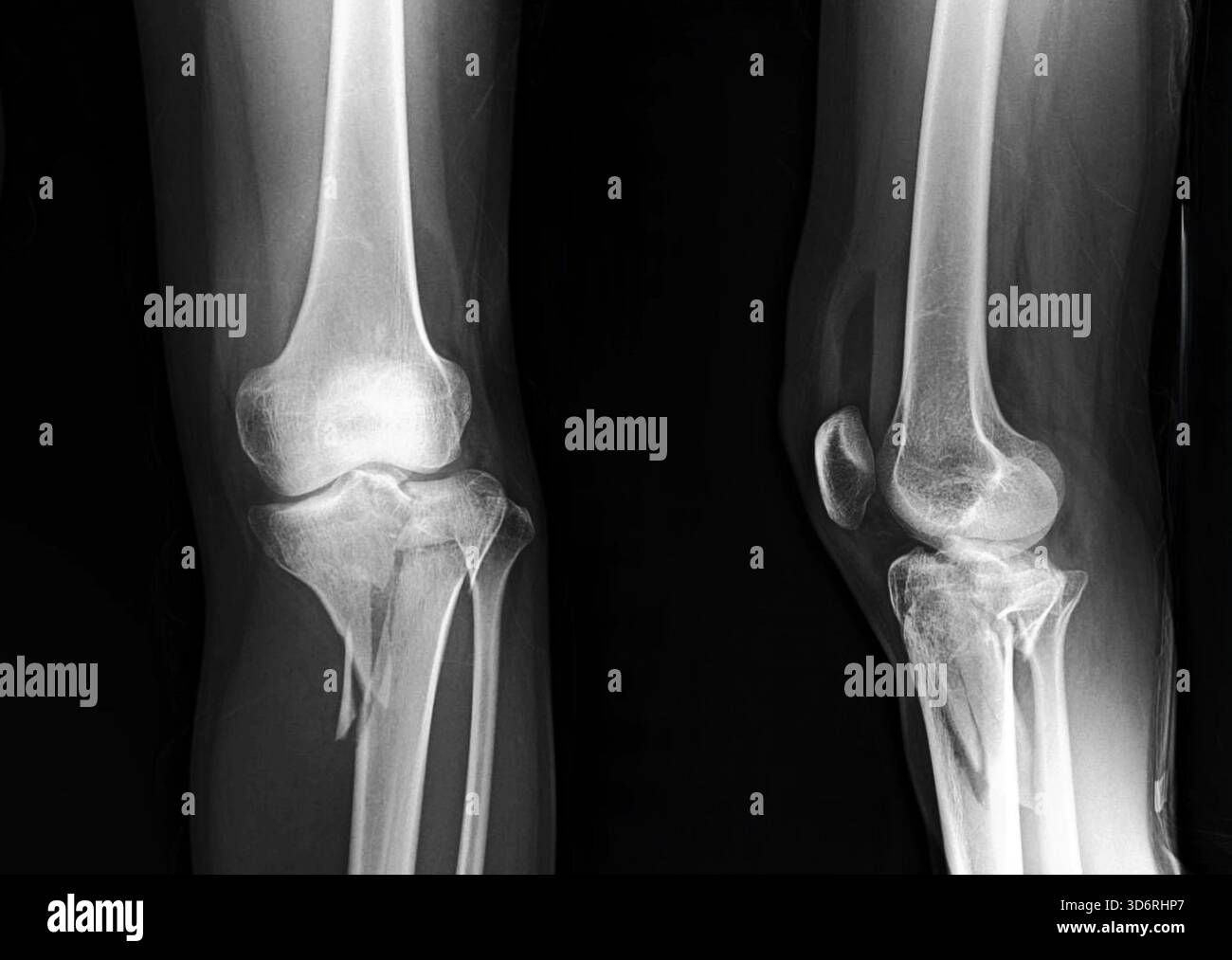 Associated leg bones hi-res stock photography and images - Alamy