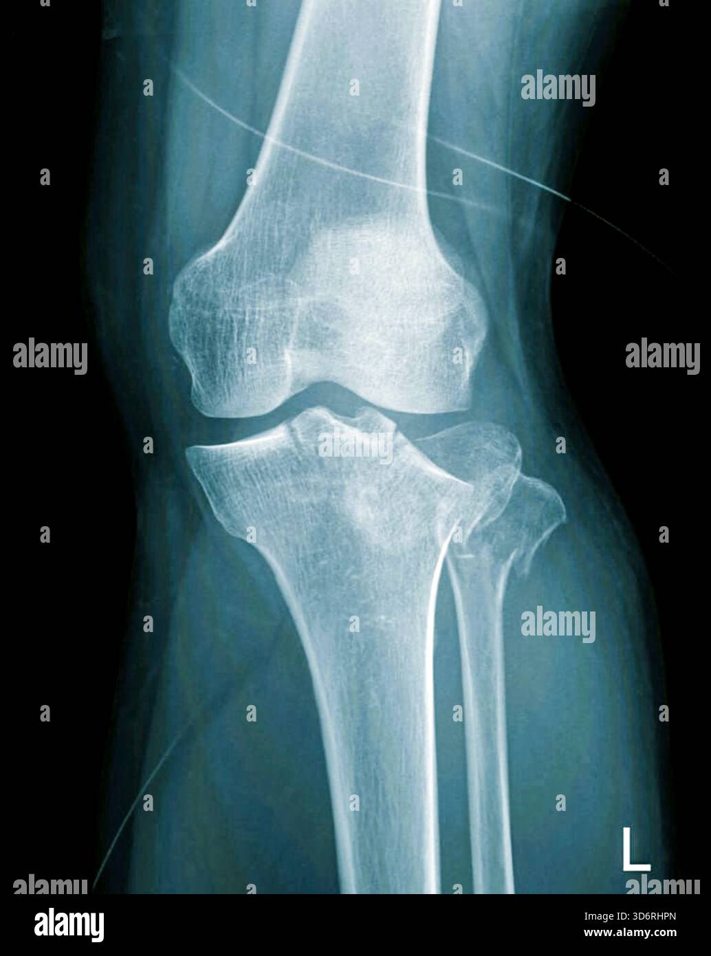 Associated leg bones hi-res stock photography and images - Alamy